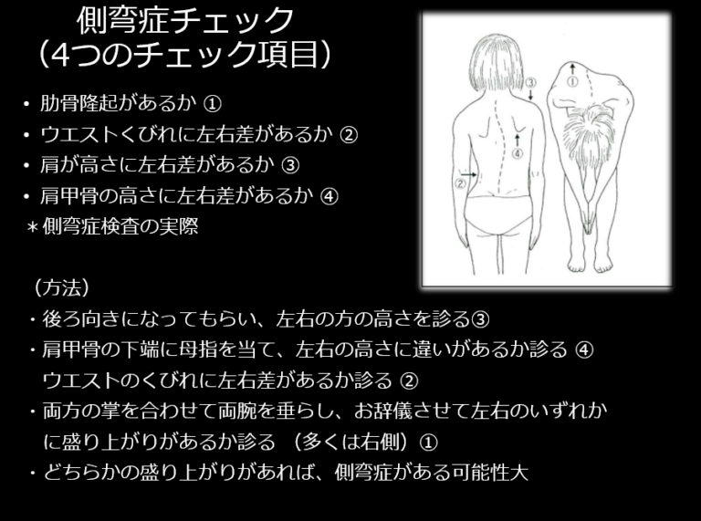学校の健康診断で側弯症を指摘された 心配しないでください。しっかり予防改善できます。ドイツ認定シュロス側弯症セラピストがご相談にのります